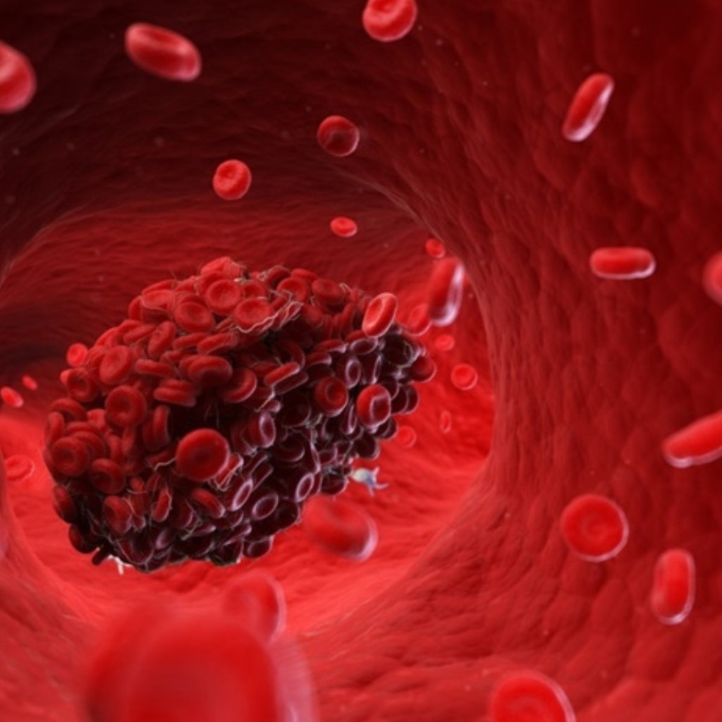 Coagulation Pariksha Biotech Pvt Ltd Coagulation Pariksha Biotech Pvt Ltd